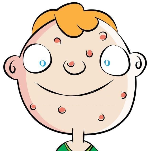 Иконка канала Pimples_man