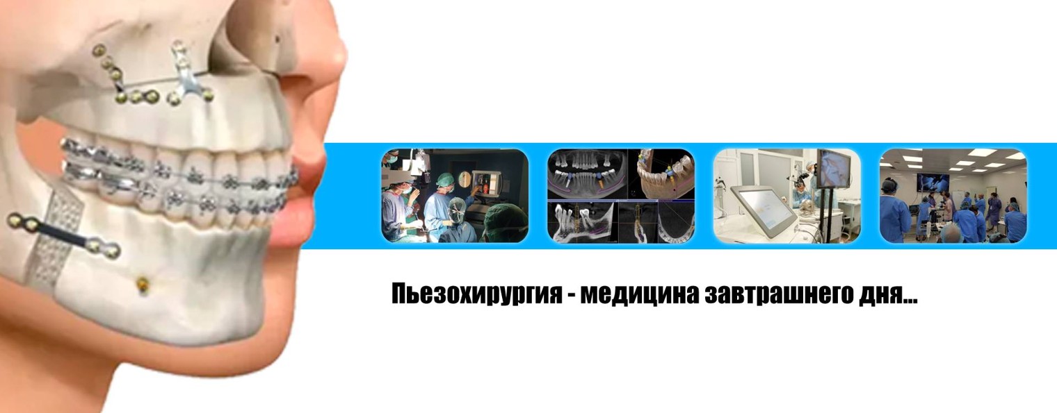 PiezoAcademy