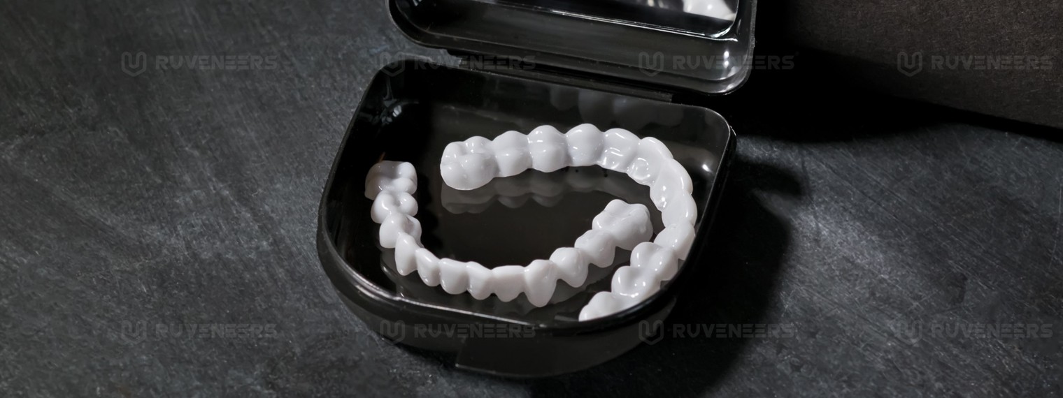 RUVENEERS – Индивидуальные съемные виниры