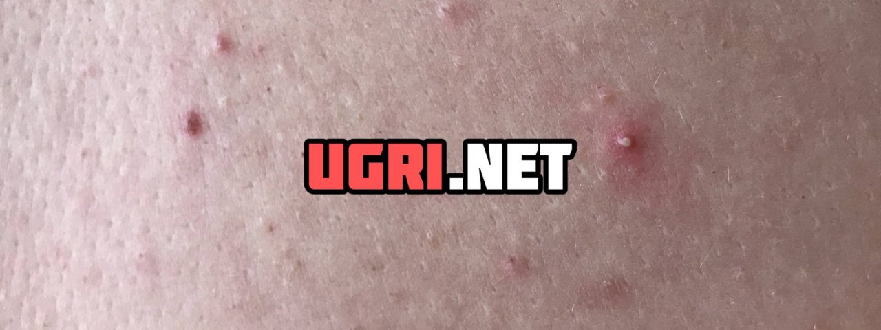 Ugri Net