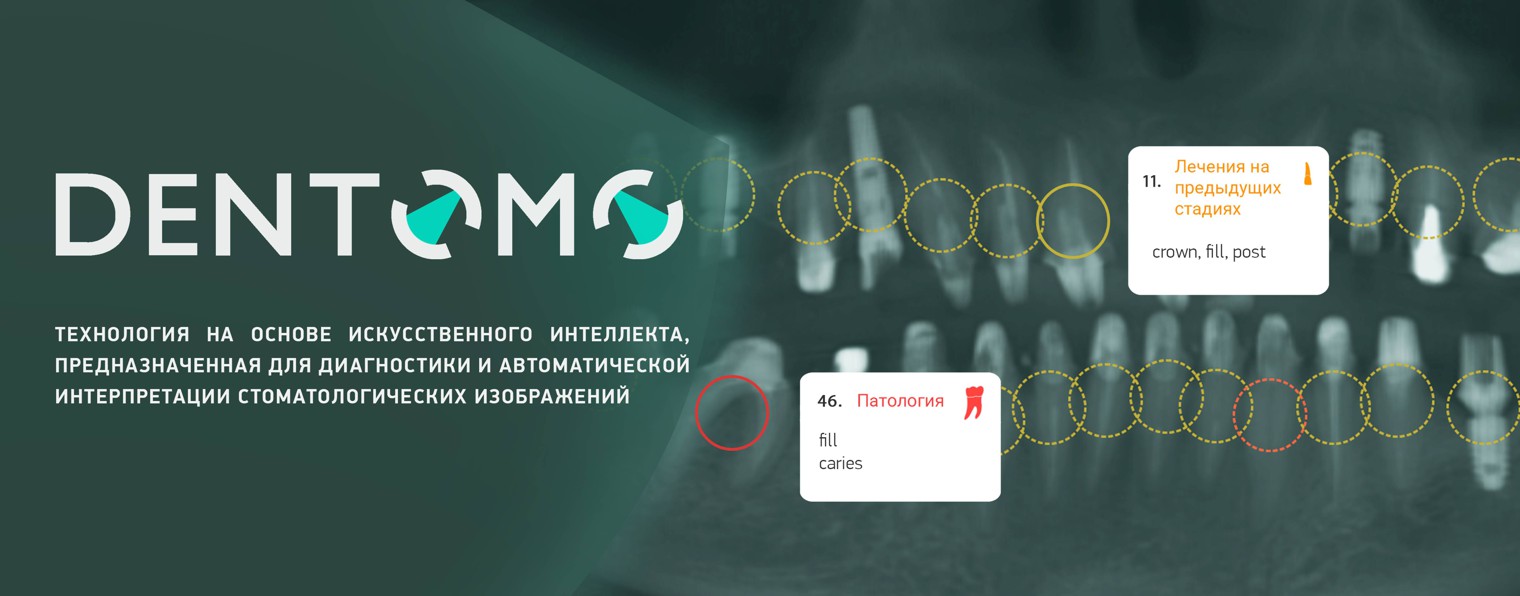 DENTOMO