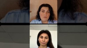 Прямой эфир :
«Детские страхи на приёме у стоматолога. Профилактика и уход за молочными зубами».