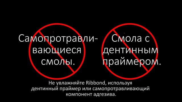Шинирование при пародонтите при помощи Ribbond
