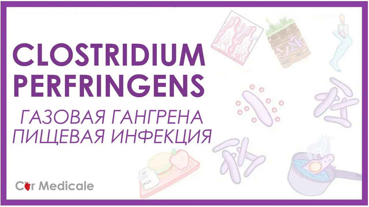 Причина газовой гангрены и пищевых отравлений - Клостридия： патогенез, симптомы, лечение