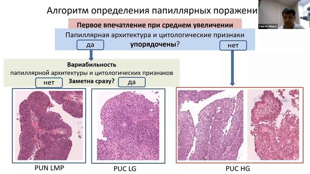 4 из 7. Алгоритм диагностики папиллярных поражений