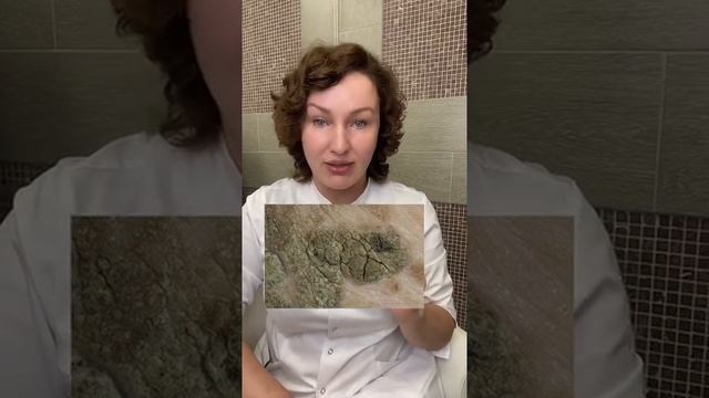 Уход за кожей необходим в любом возрасте!