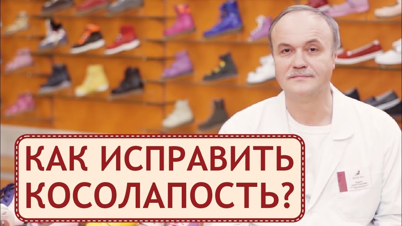 Лечение косолапости с помощью ортопедической обуви. Косолапость лечение. Персей. 12+.mp4