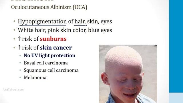 Дерматология USMLE - 1. Общее - 5.Пигментные нарушения