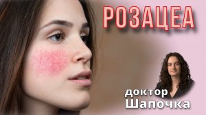 Доктор Шапочка. РОЗАЦЕА | Беседы с дерматологом