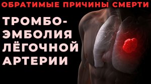 Тромбоэмболия лёгочной артерии как обратимая причина клинической смерти