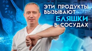 Эти продукты вызывают бляшки в сосудах!