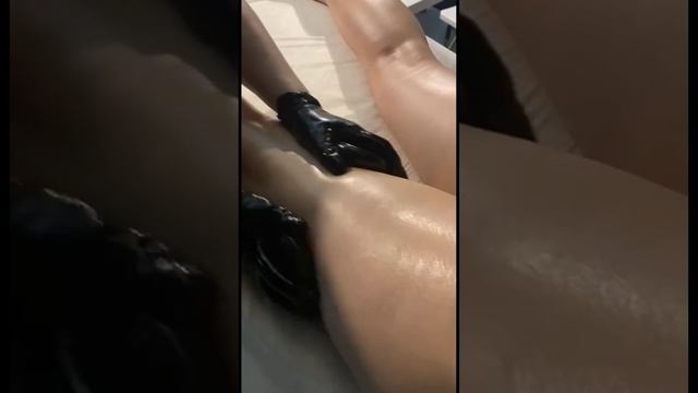 Стоун-терапия