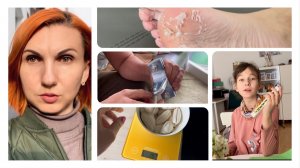 Я в Ремисси ♀️ Результат Кислотного Пилинга  Артём о Тренировке  Влог 10.05.2023