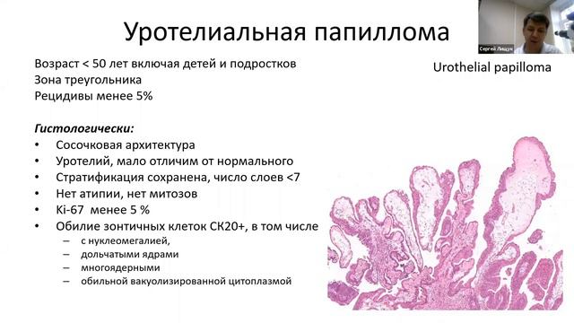 2 из 7. Папилломы