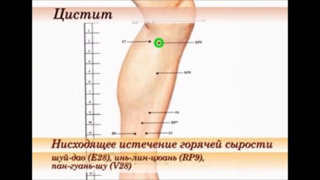 если цистит (секрет исюэтун).