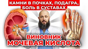 Мочевая кислота — страшная ОПАСНОСТЬ! Диета для выведения мочевой кислоты