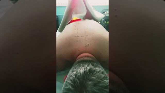 Испытано на себе, рефлексотерапия.