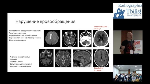 Дифференциальная диагностика в нейрорадиологии (МРТ)