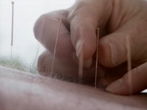 Природные лекарства (Natural Remedies)
