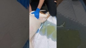 спускание мочи методом массажа без катетера