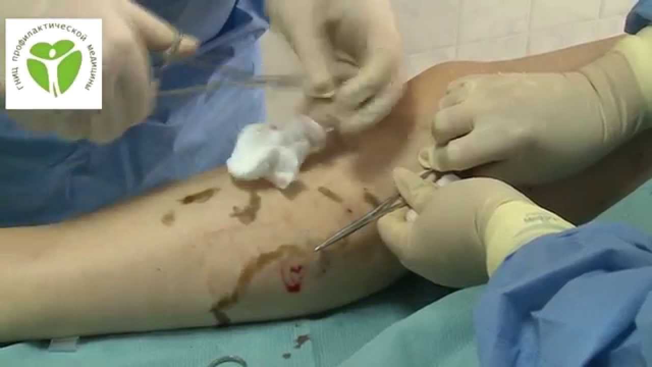 сердечно-сосудистая хирургия