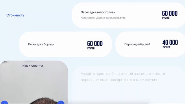 Кейс по разработке landing page для компании «Скажи волосам ДА» клиника по пересадке волос