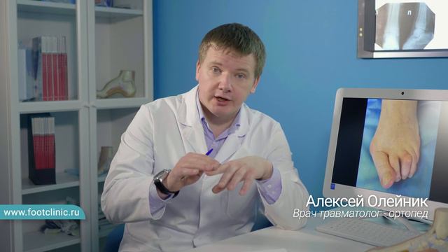 Молоткообразные пальцы: особенности лечения доктор Алексей Олейник #footclinic