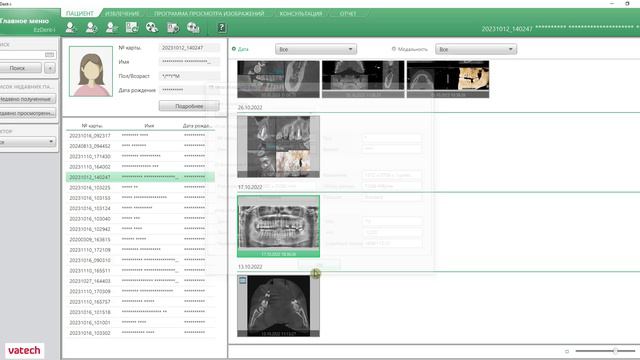 Определение лучевой нагрузки от КТ и ОПТГ исследований.