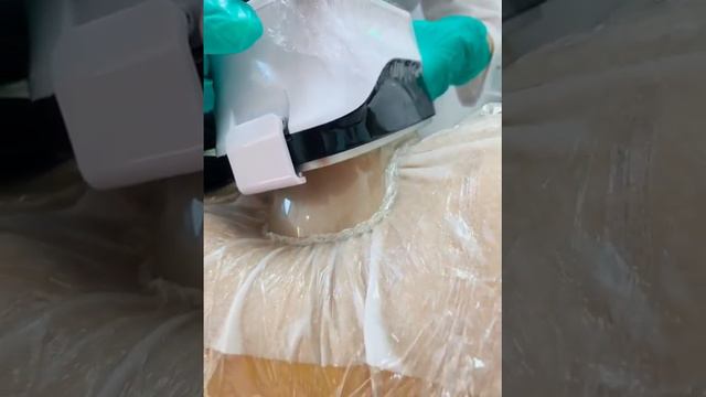 криолиполиз проведение процедуры