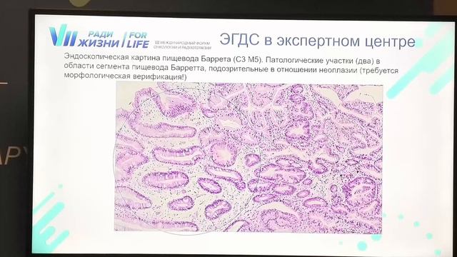 2024 09 18 05 Кайбышева ВО Сложные случаи дифференциальной диагностики опухолевого и неопухолевого п