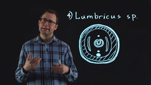 Черви. Марьинский.