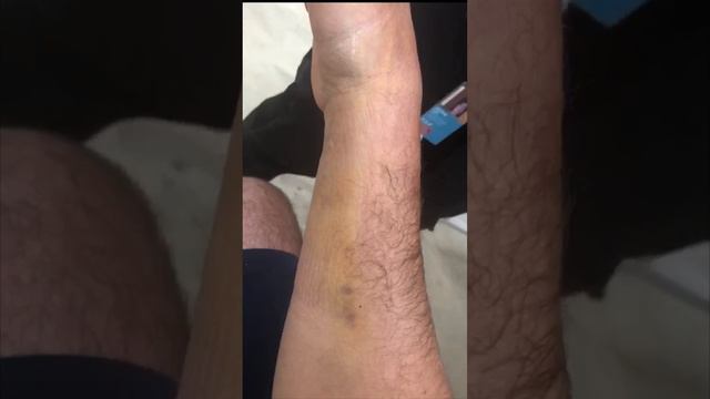 В госпитале, Dakar 2018