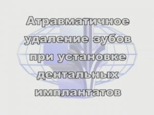 Примеры атравматичного удаления зубов
