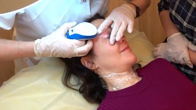 Обзор обучающего семинара по блефаропластике на аппарате Plasma Eyelid Pen (плазмапен) | Scopula.ru