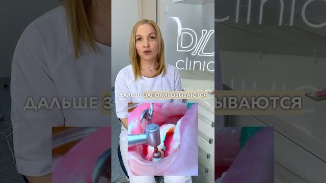 Этапы профессиональной гигиены полости рта