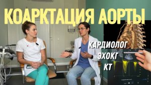 Коарктация аорты в 30+. Роды с коарктацией аорты. Кардиолог. ЭхоКГ -как не пропустить коарктацию. КТ