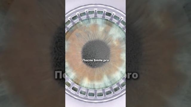 На что мы потратили много миллионов рублей?