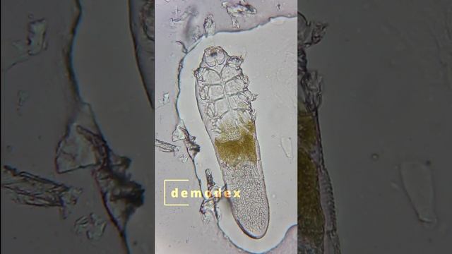 Demodex folliculorum