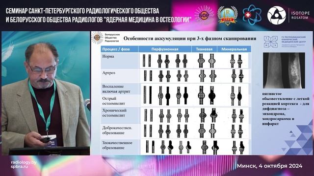 Трехфазная остеосцинтиграфия с ОФЭКТ/КТ. Роль в диагностике костной патологии.