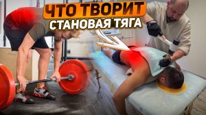 Штанга убила спину Петра