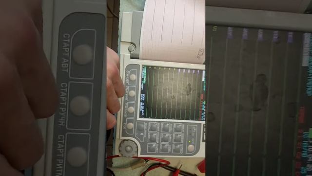 Ремонт ЭКГ электрокардиографа и техническое обслуживание