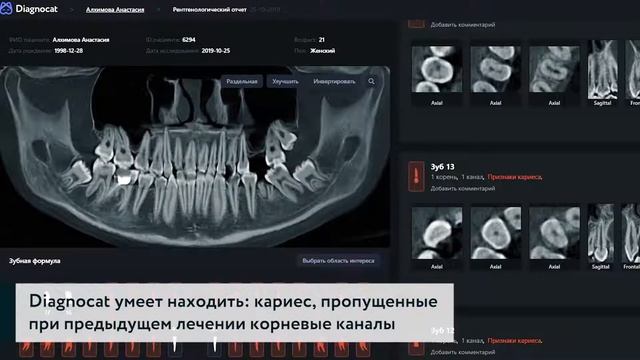 Искусственный интеллект Диагнокат. Безошибочная диагностика