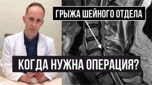 Грыжа и стеноз шейного отдела позвоночника. Сдавление спинного мозга и шейная миелопатия