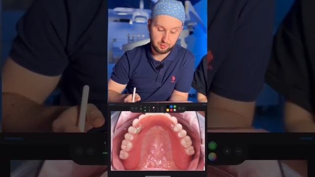 Что делать при полной потере зубов? Решение от команды врачей Belgravia Dental Studio