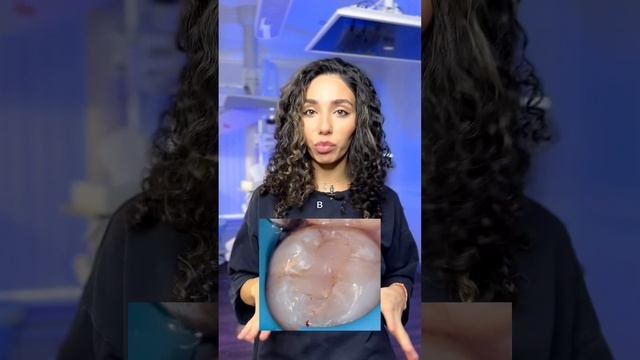 ⚡ 3 действия, которые помогут понять, хорошо ли выполнена пломба!