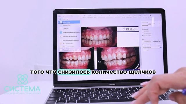 Дисфункция височно-нижнечелюстного сустава (ВНЧС)