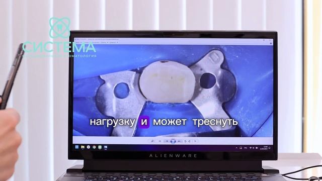 Апикальный периодонтит