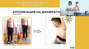 Как_включить тейпирование вработу_логопеда. Триада тейпирования.