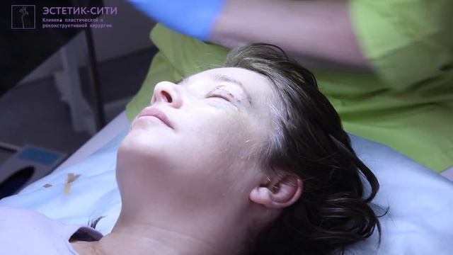 Пластика нижних и верхних век