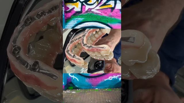 Постоянный керамокомпозитный протез включен в стоимость операции All-On-4 - Неватекс отзывы